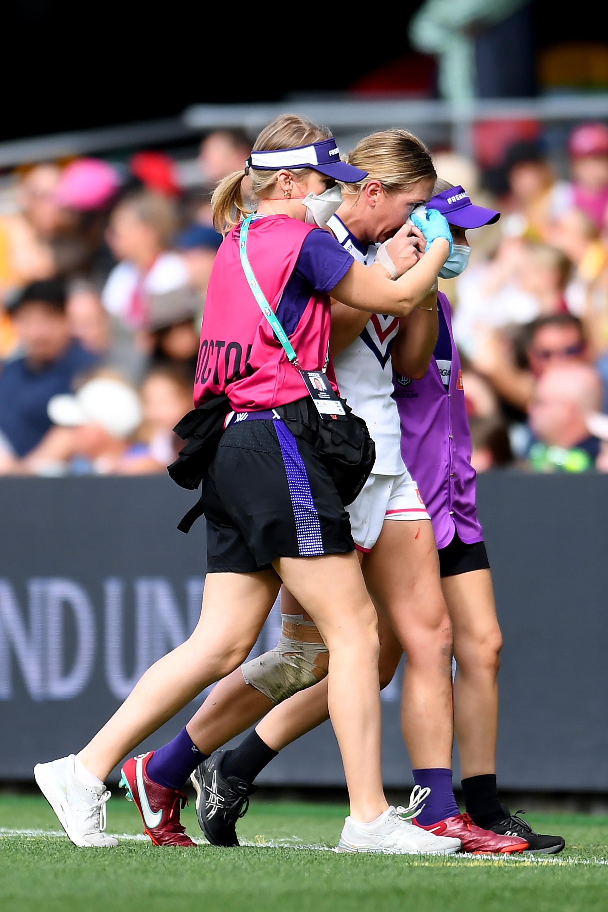 AFLW Injury Update: Round 2