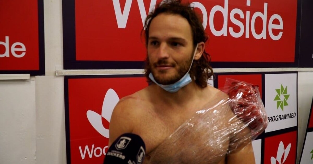 'Have to be more consistent' | James Aish